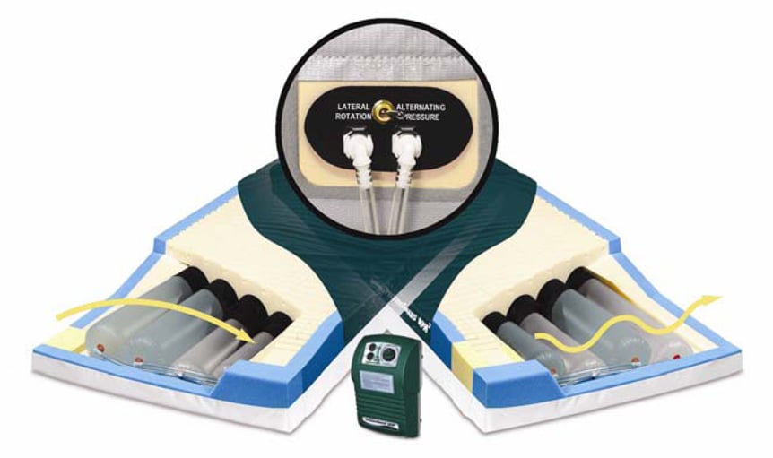 PressureGuard® APM2 - Transfer Master